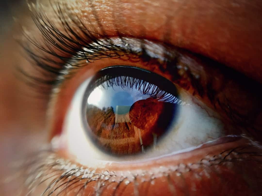 Understanding Retinal Tears and Detachments: Early Warning Signs You ...